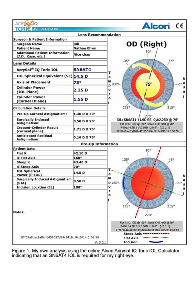 Time for IOL Surgery - mivision