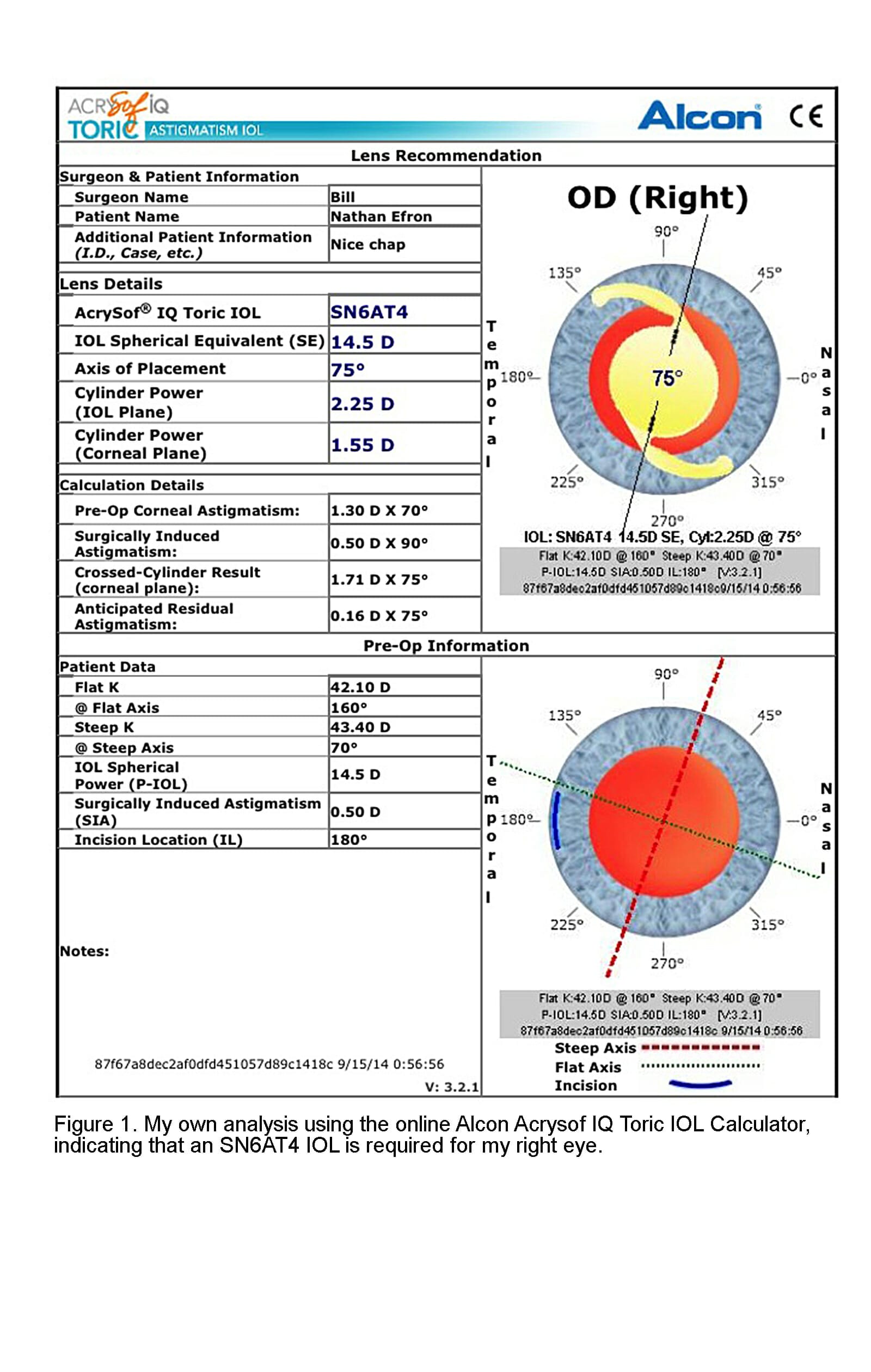 Time for IOL Surgery - mivision