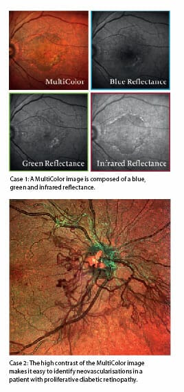 Spectralis OCT: MultiColor Scanning Laser - mivision
