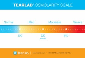 TearLab - mivision