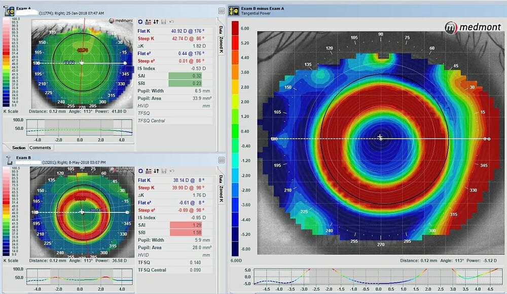 The Power and Potential of Orthok - mivision