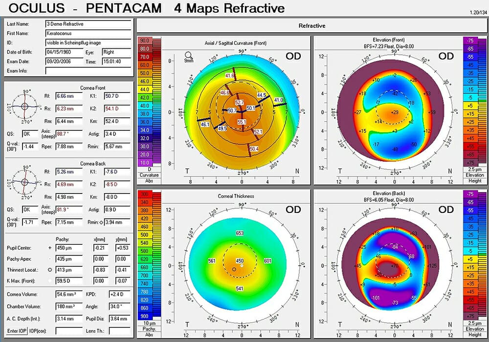 Cataract Surgery and IOLs: What the Doctor Ordered? - mivision