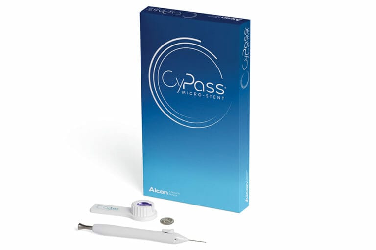 CyPass Micro-Stent - mivision