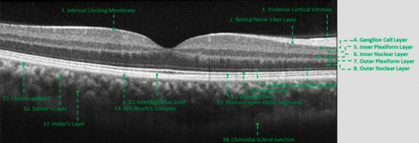 OCT and Me – A Beginner’s Guide - mivision