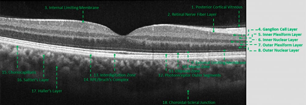 OCT and Me – A Beginner’s Guide - mivision