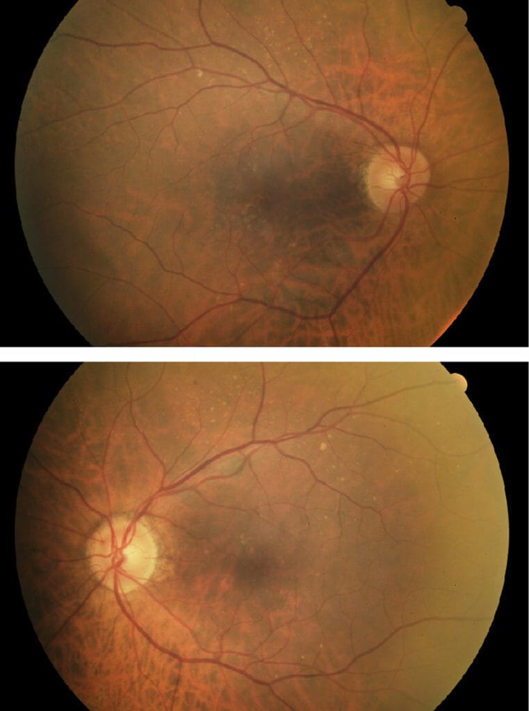 OCT and Me: A Beginner’s Guide - mivision