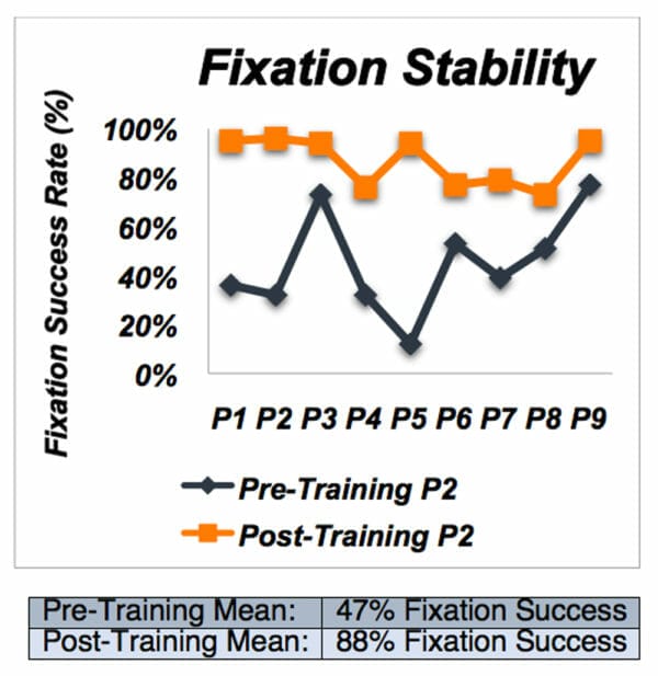 A Road Less Travelled: Technical Advances in Eccentric Viewing - mivision