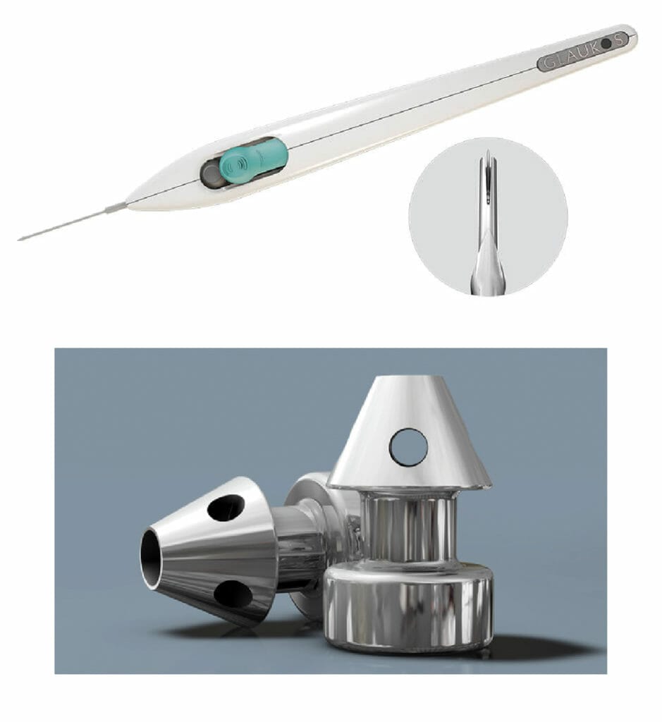 MIGS: What’s Happening Now and On the Horizon - mivision