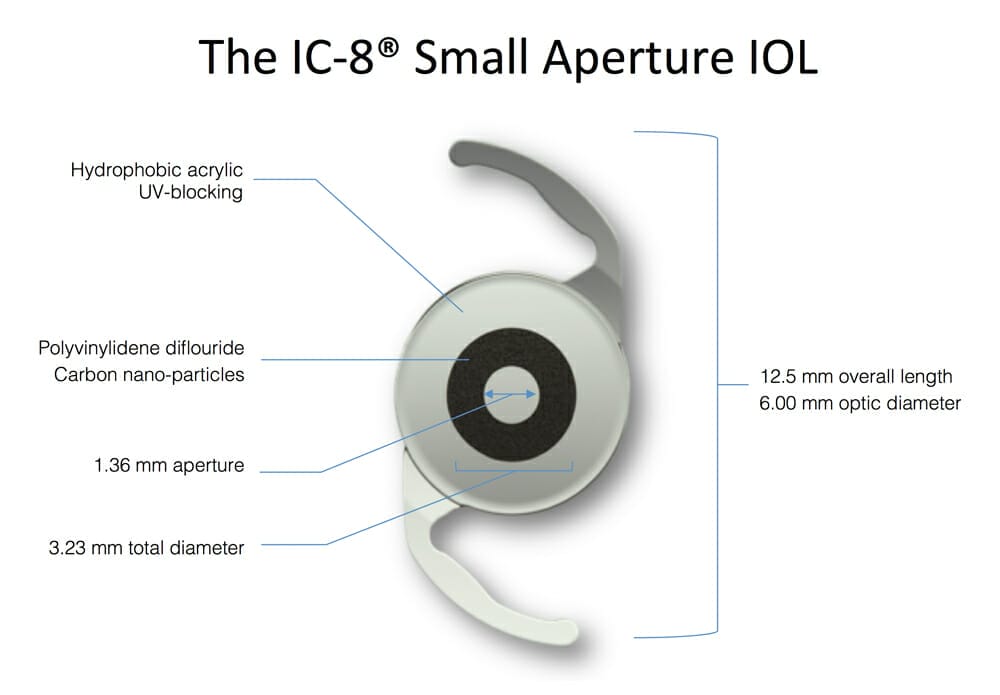 Maximising Presbyopia Correction with Extended Depth of Focus IOLs ...