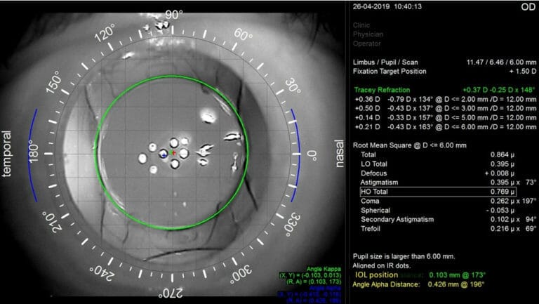 Femtis EDOF: Predictable Positioning, Clear Vision - mivision