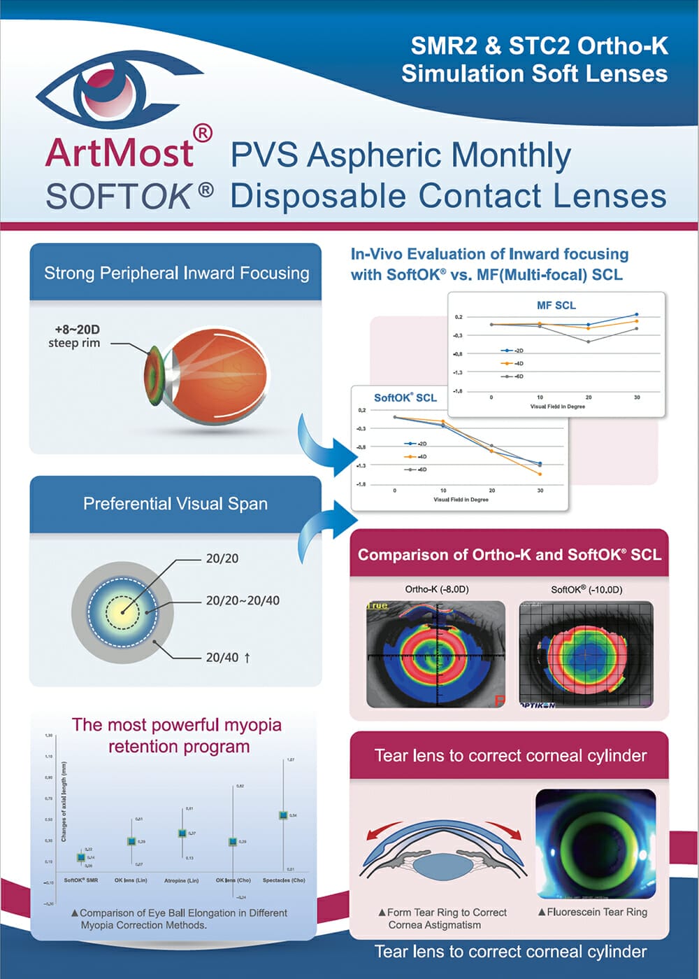 Myopia: Options for Optical Control - mivision