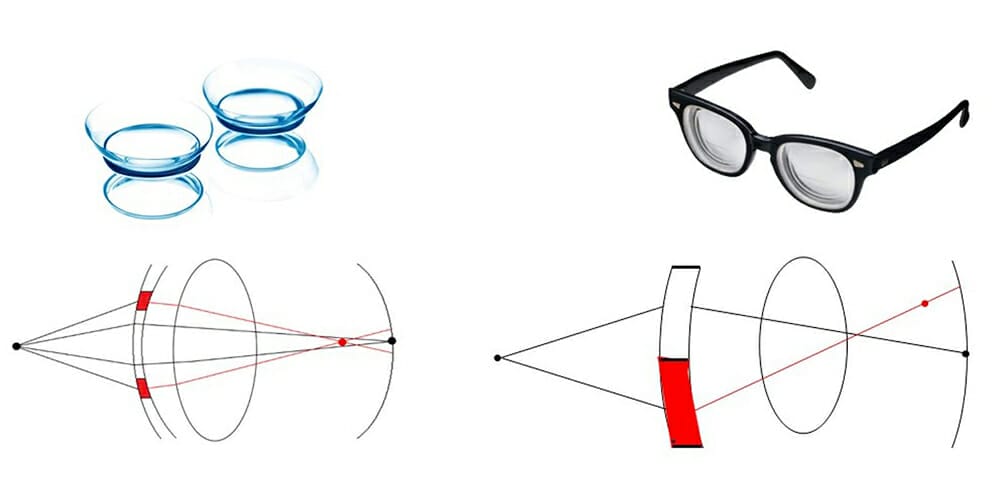 Spectacles: a Viable Control - mivision