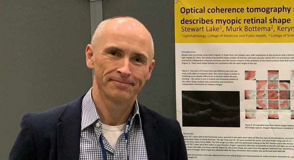 OCT Faster, Cheaper Tests For Myopia Possible - mivision