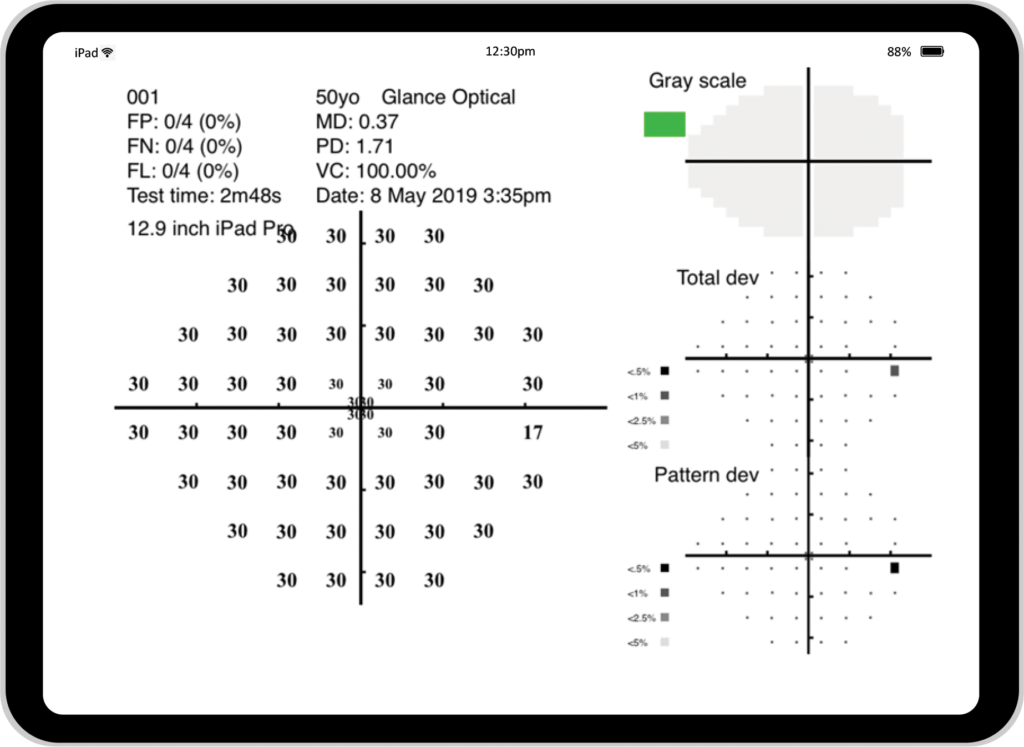 MRF Changes the Perimetry Paradigm - mivision