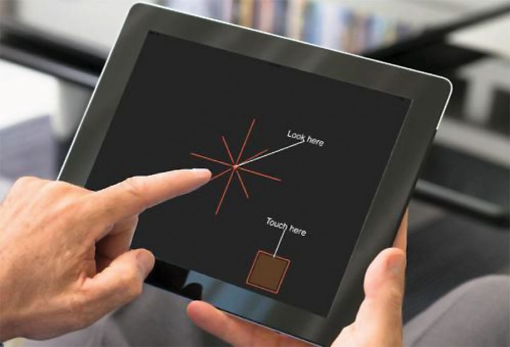MRF Changes the Perimetry Paradigm - mivision