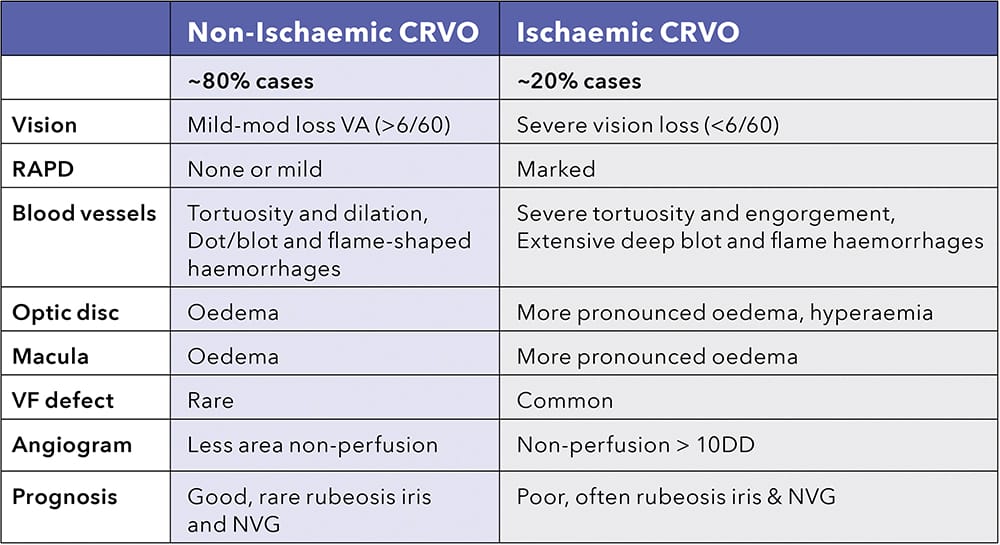 CRVO: Managing the Consequences - mivision