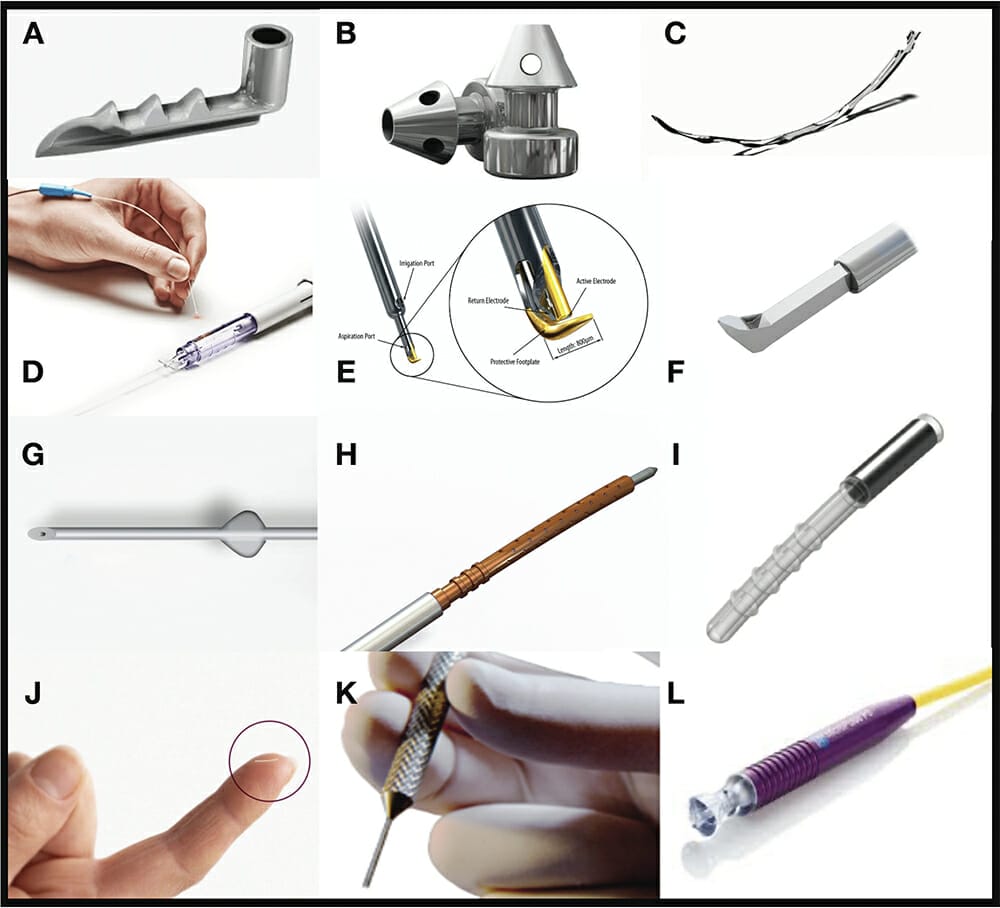 MIGS in 2020: Reviewing the Devices and Techniques - mivision