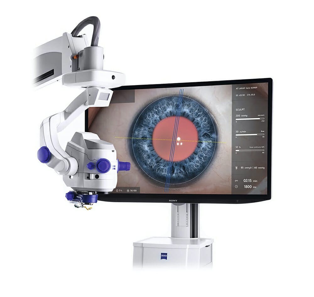Cataract Surgery: Evaluating Evolving Technologies - mivision