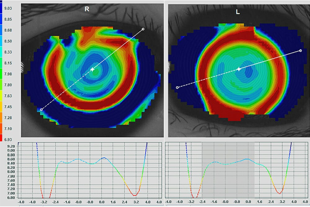 OK: Getting the Mix Right - mivision