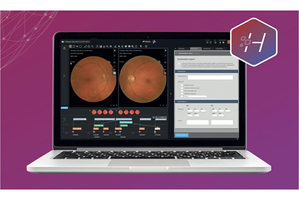 Topcon Harmony Data Management Solution - mivision Topcon Harmony Data Management Solution - mivision