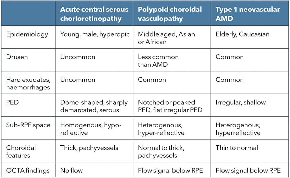 Macular Subretinal Fluid A Diagnostic Approach - mivision
