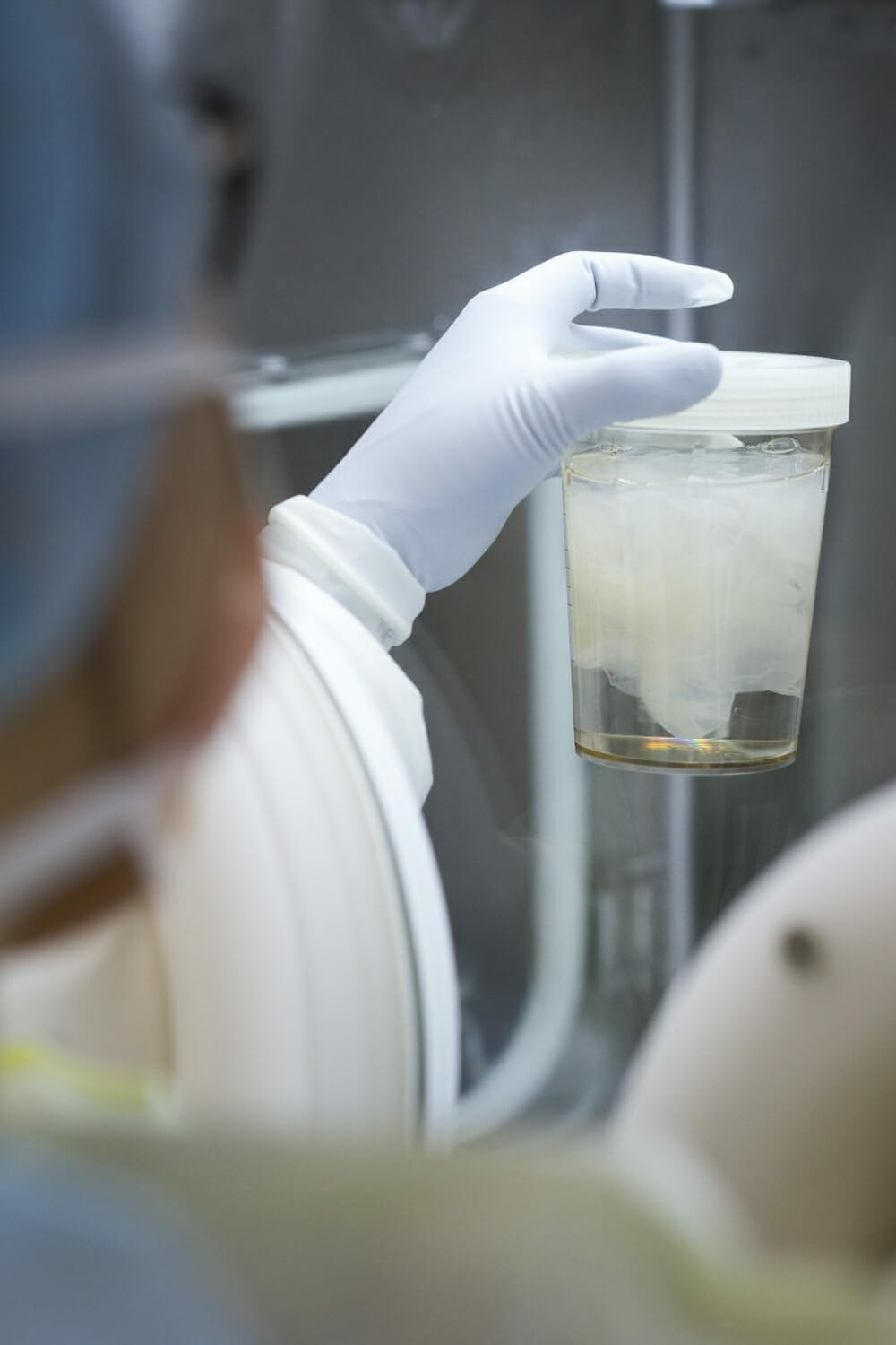 The Cycle Of Life Amniotic Membrane For Healing Mivision