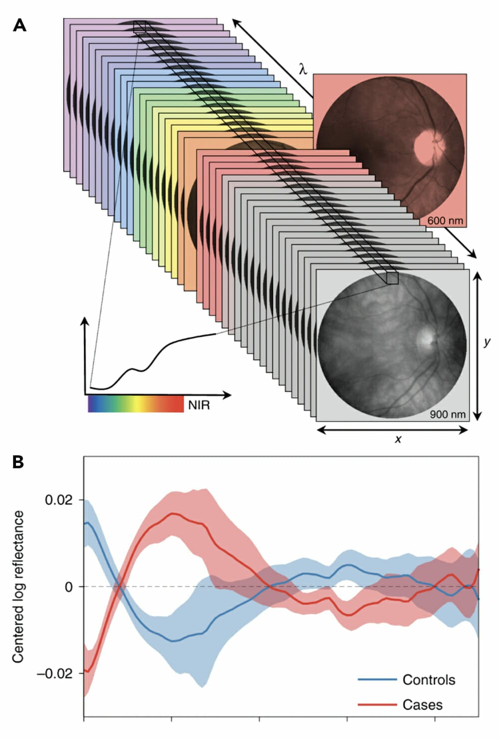 The Retina as a Window to the Brain: Imaging Biomarkers for Alzheimer’s ...