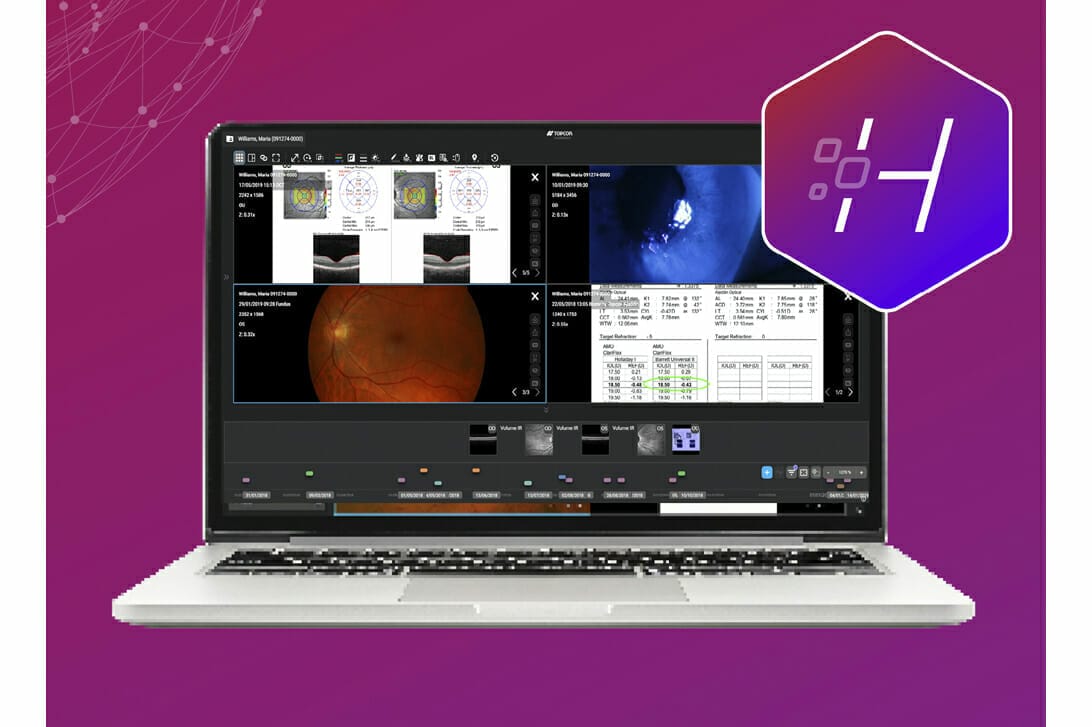 Topcon Harmony Data Management Solution - mivision Topcon Harmony Data Management Solution - mivision