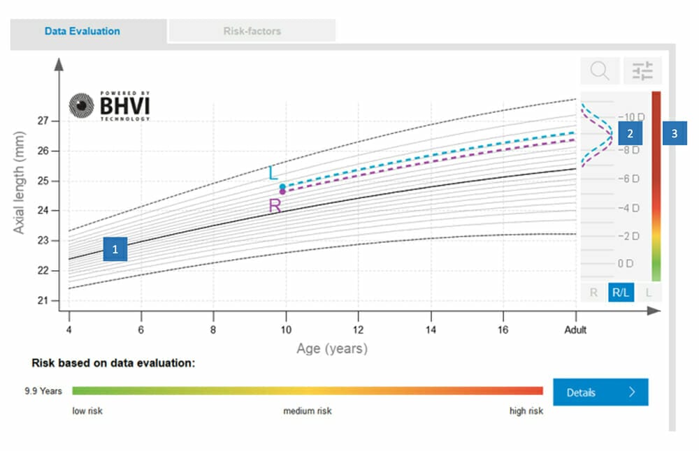 Predicting Onset and Progression of Myopia: Axial Length Percentile ...