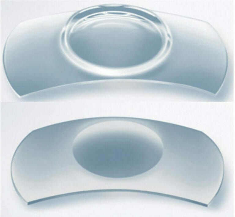 Refractive Correction with Phakic Intraocular Lenses - mivision