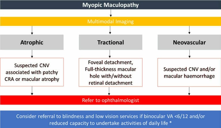 Myopic Maculopathy: A Practical Guide - mivision