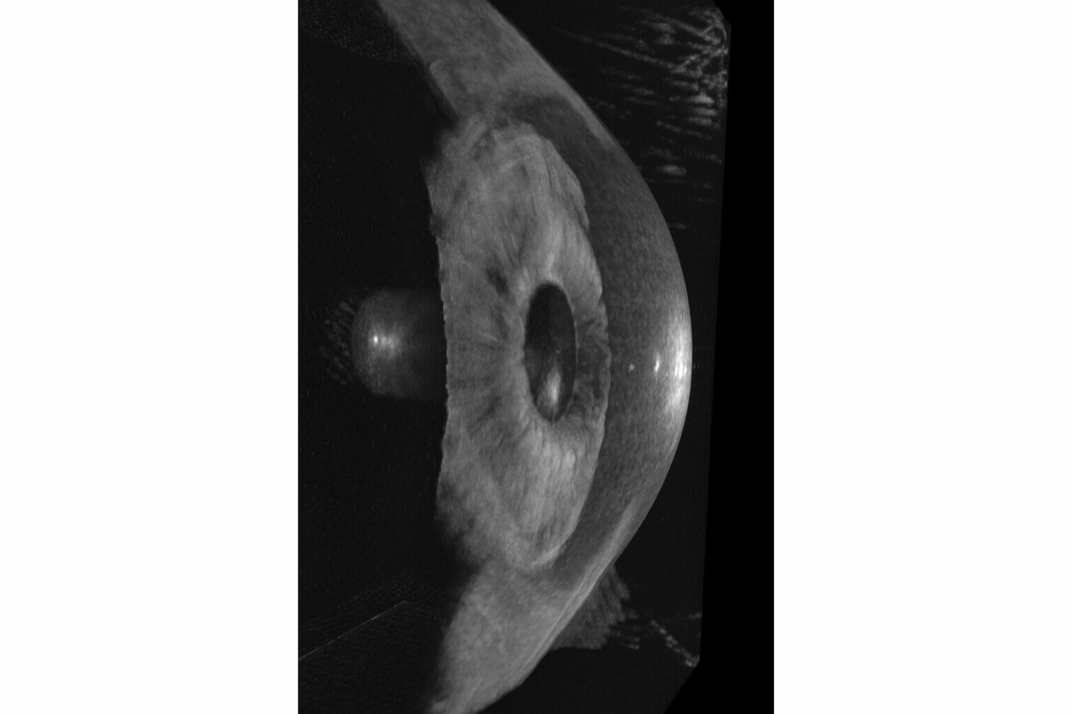 Cylite HP-OCT - mivision