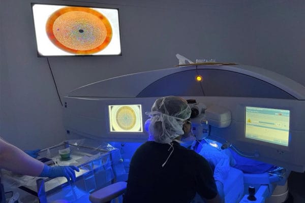 Laser Refractive Surgery Options - mivision