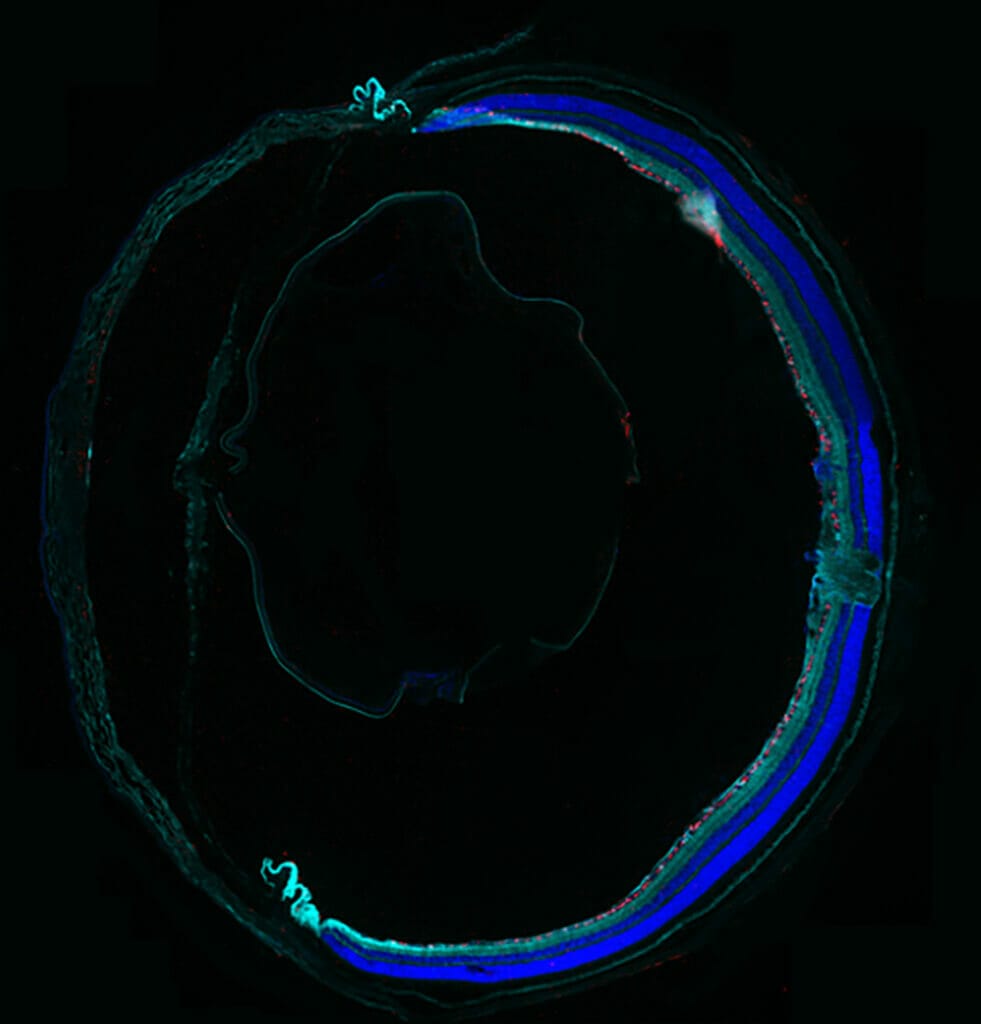 Recharging Glaucoma Research - mivision