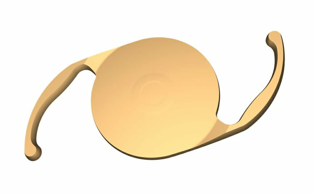 IOL Selection in Patients with Glaucoma - mivision