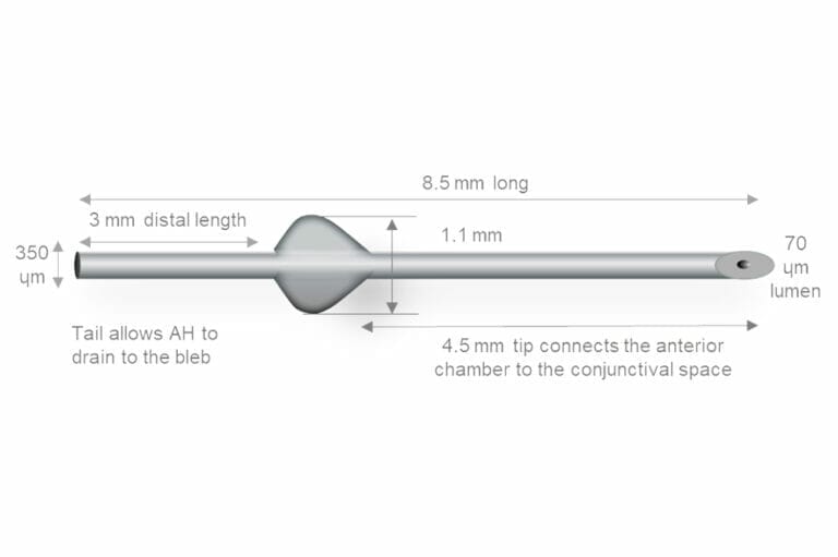 Preserflo Microshunt - mivision
