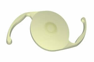 AcrySof IQ Vivity IOL - mivision