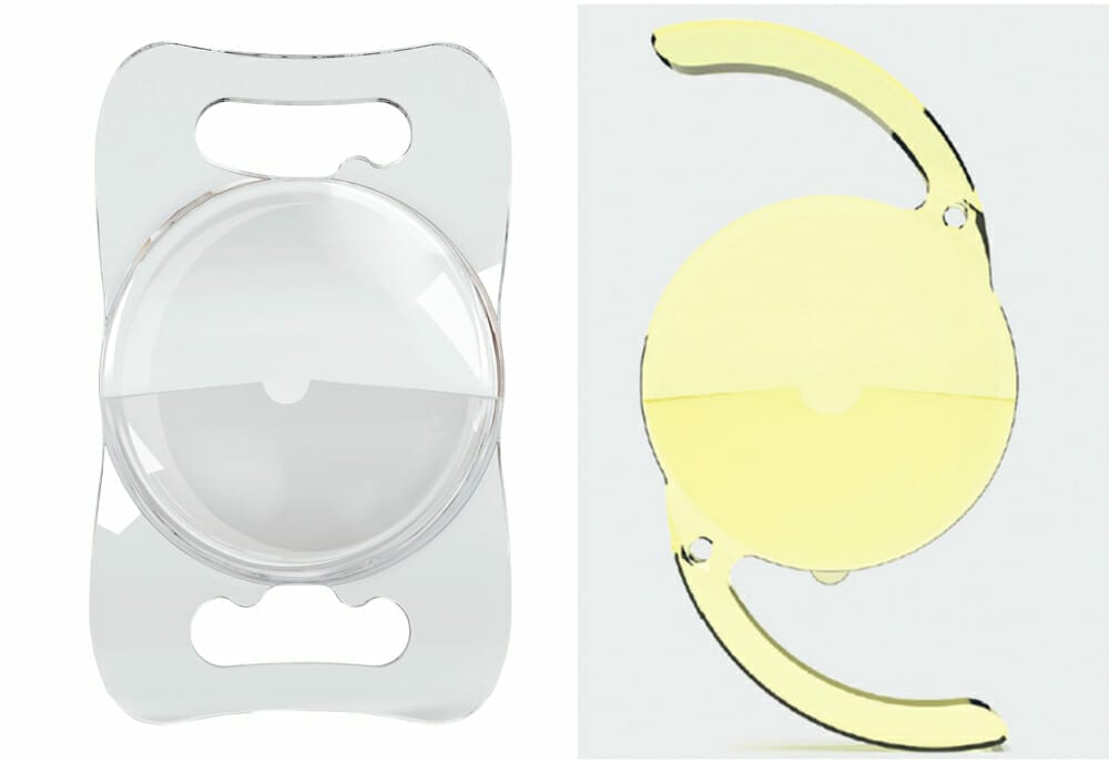 Cataract Surgery in 2022: Extending the Range - mivision