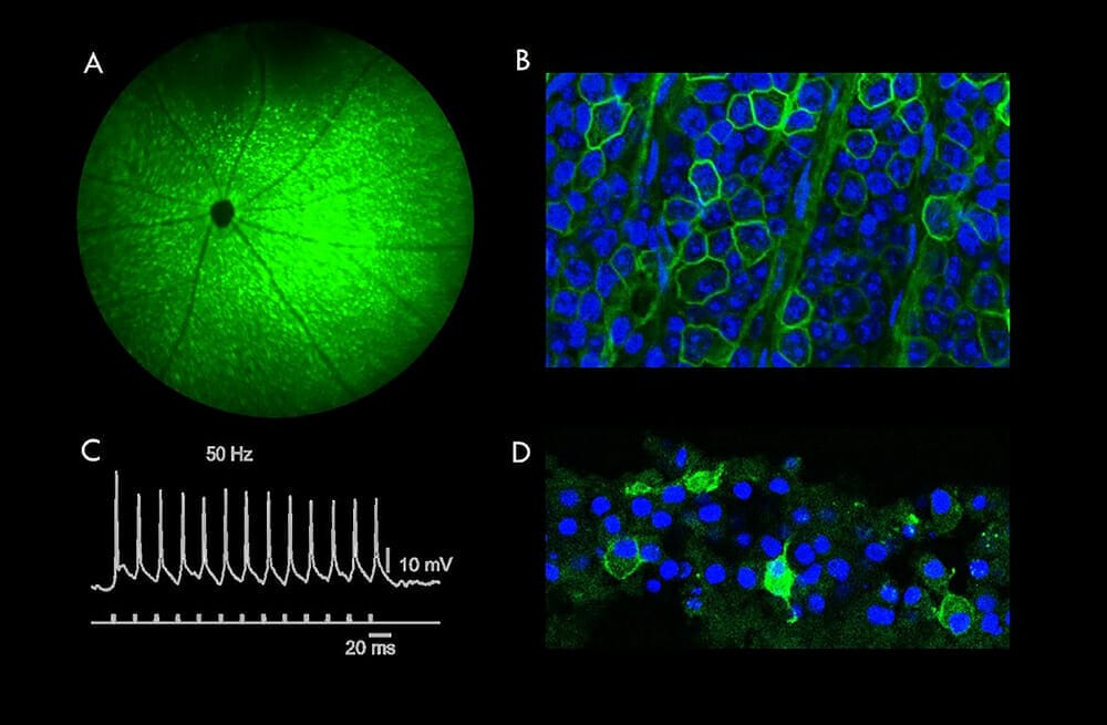 Optogenetic Vision Restoration – the Biological Bionic Eye - mivision