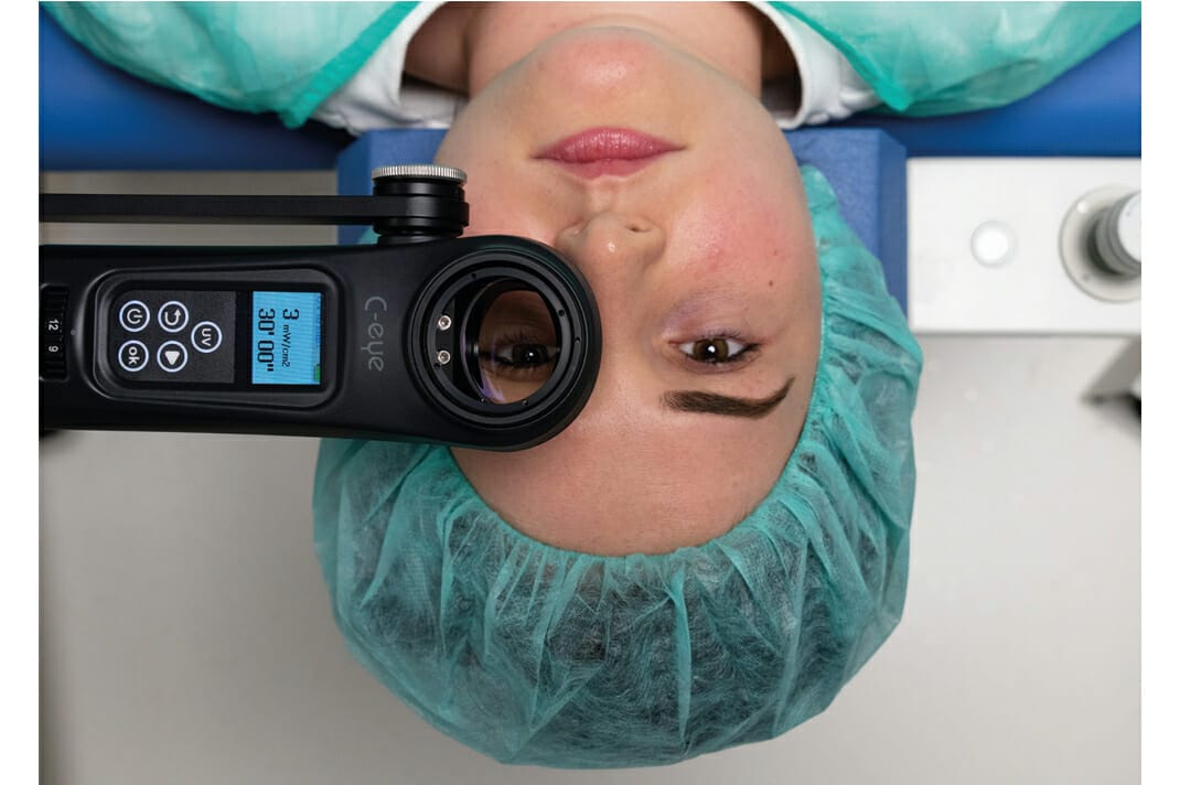 C-eye for Corneal Crosslinking - mivision