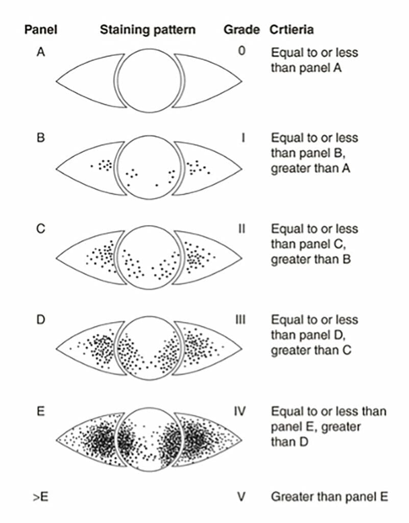 Exploring New Technologies: Ophthalmology at RPAH - mivision