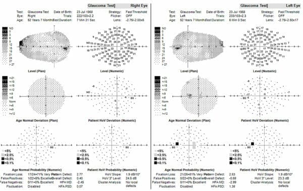 Toxic Optic Neuropathy: An Unspoken Cause of Vision Loss - mivision