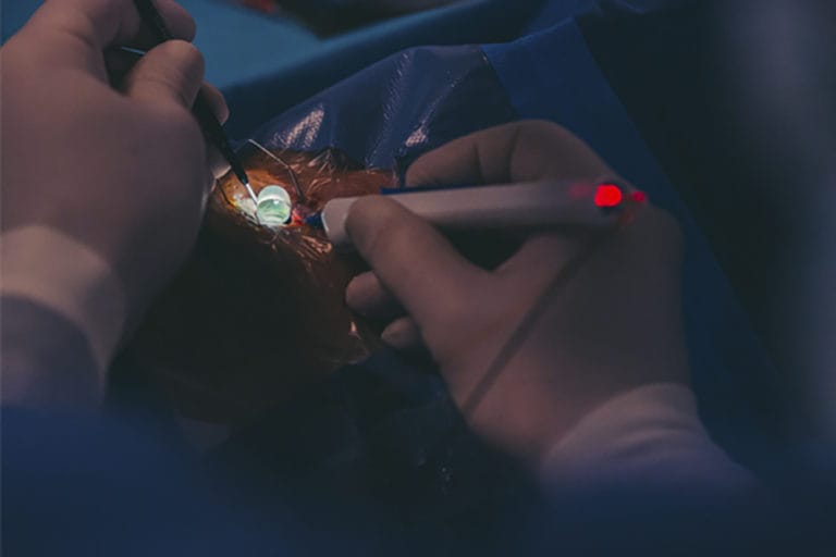 iTrack Advance Ab-interno Canaloplasty for Glaucoma - mivision