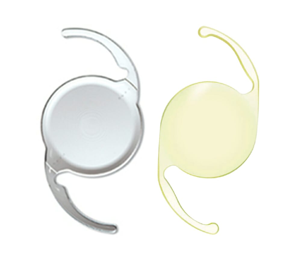 Cataract Surgery: New and Emerging Technology - mivision