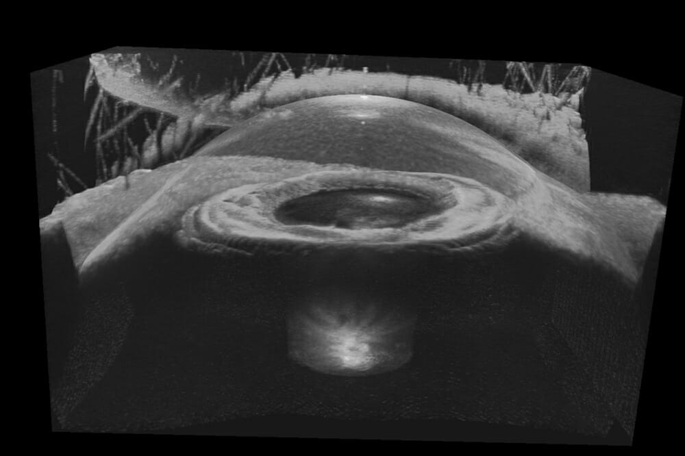 Cylite HP-OCT - mivision