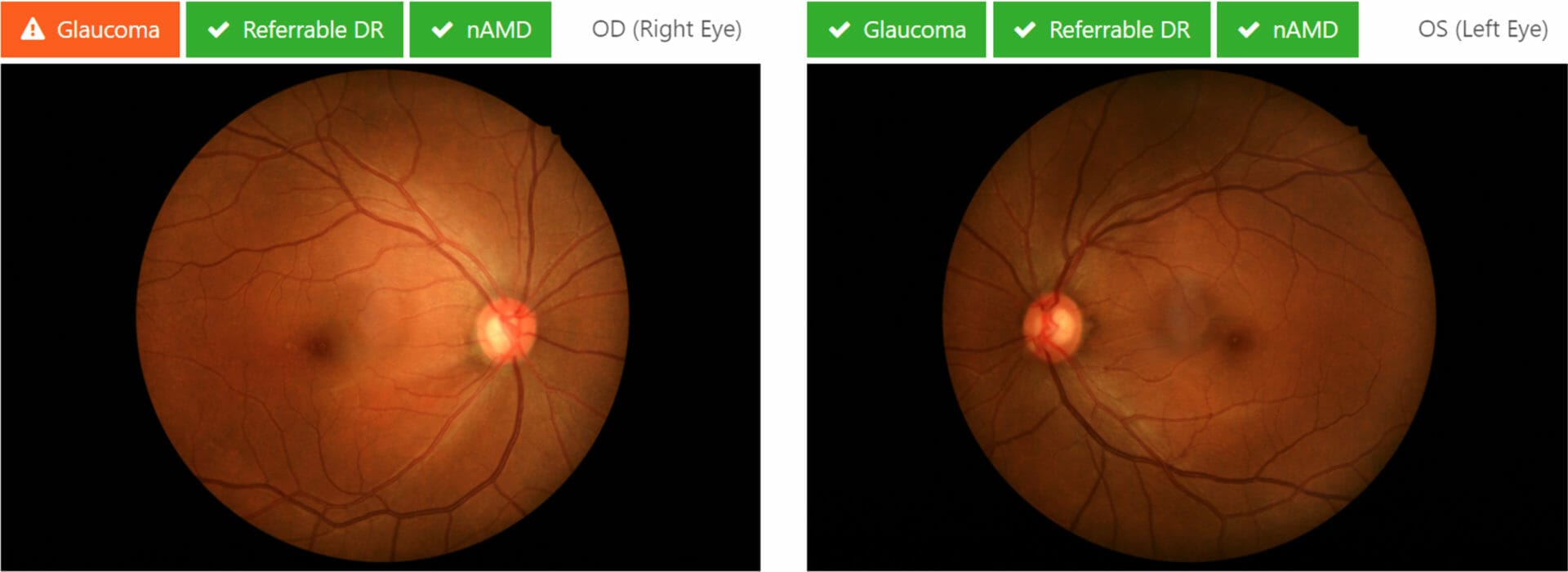 Artificial Intelligence in Eye Care: The Future is Now - mivision