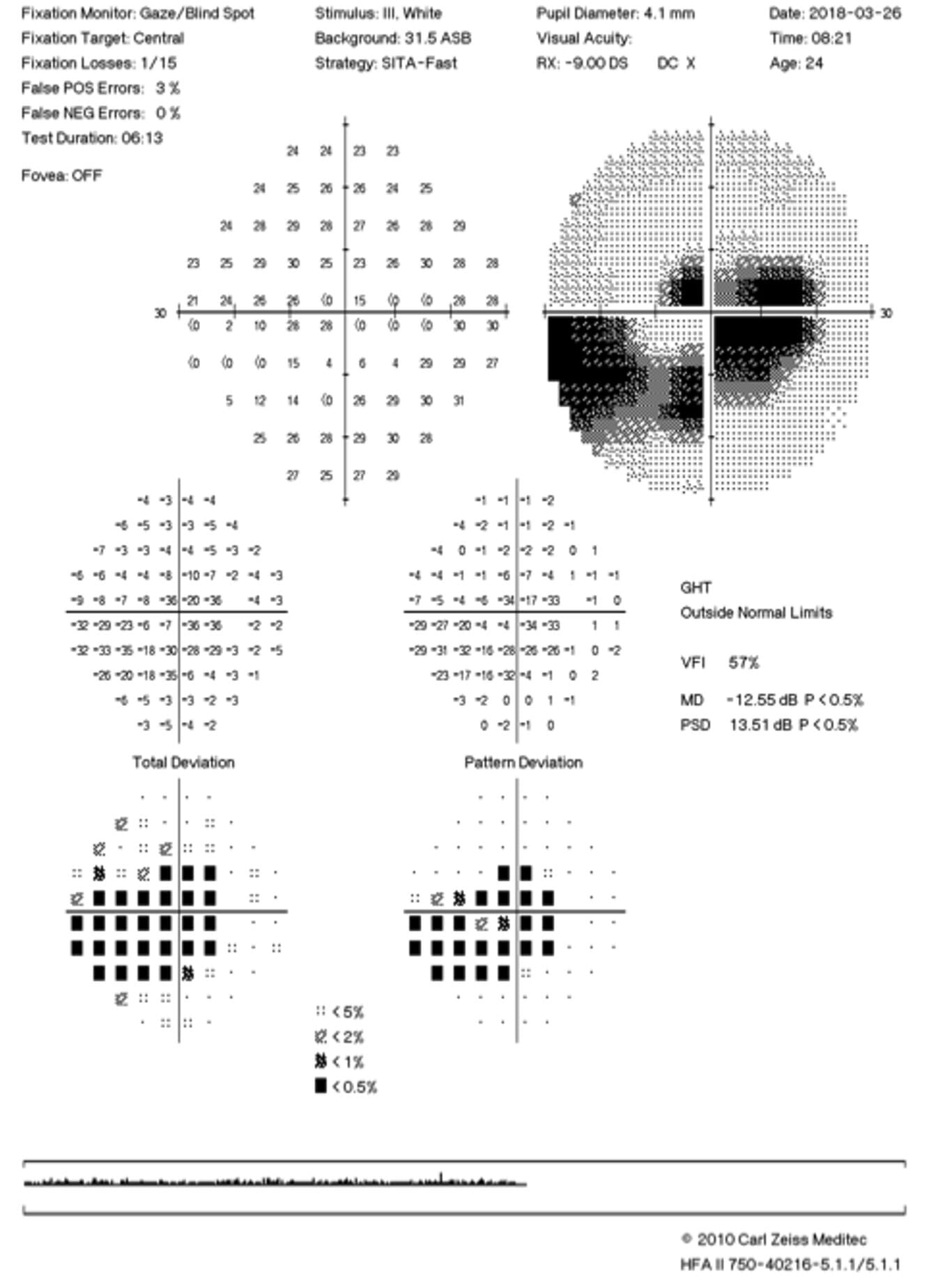 Artificial Intelligence in Eye Care: The Future is Now - mivision