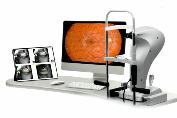 CSO Cobra+ Fundus Camera - mivision