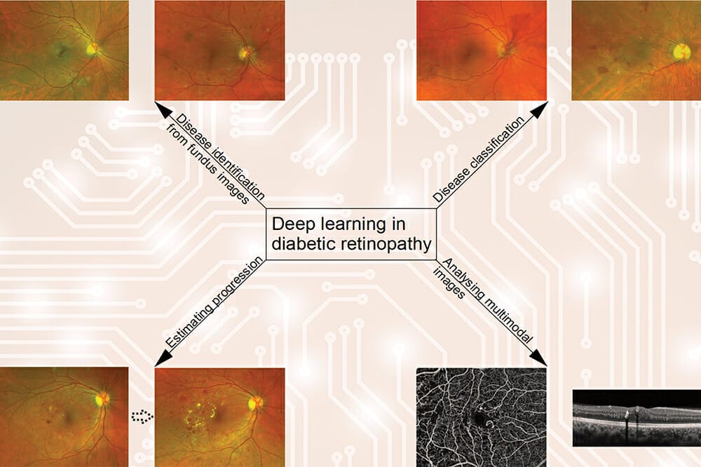 Deep Learning in the Retina - mivision