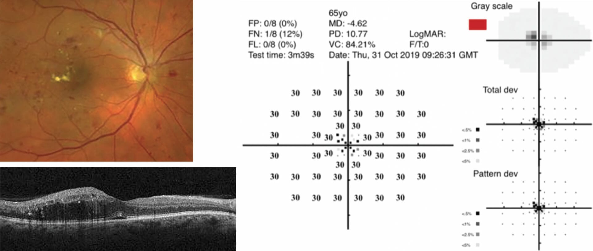 Melbourne Rapid Fields Gains Global Foothold - mivision